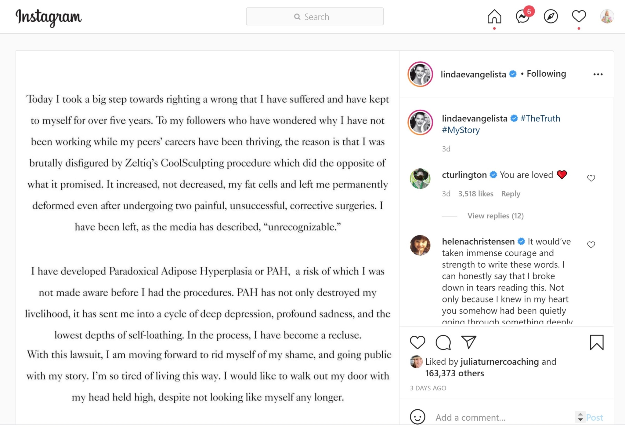 The Frailty of Beauty and The Strength of Character: Linda Evangelista ...